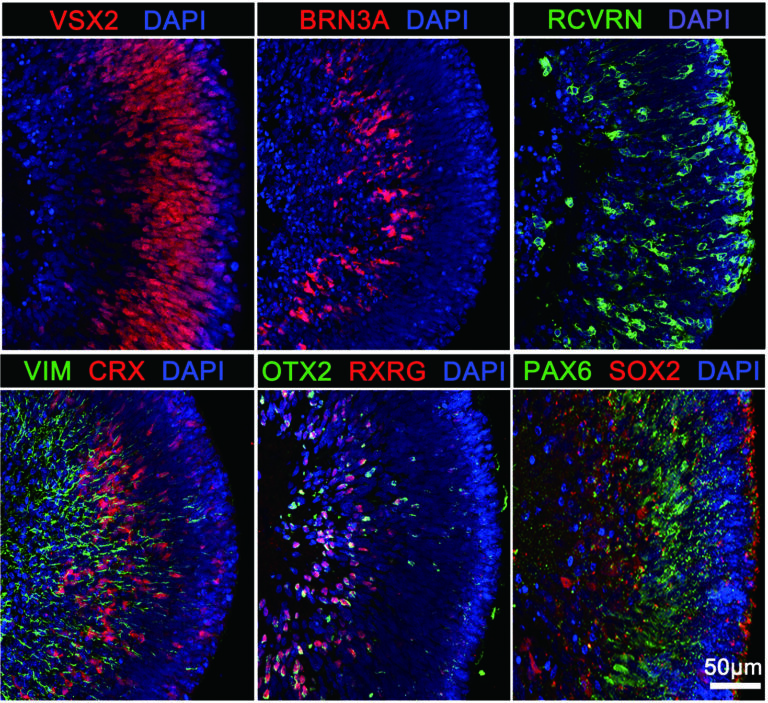 Discovery of Human Retinal Stem-Like Cells Brings Hope for Vision ...