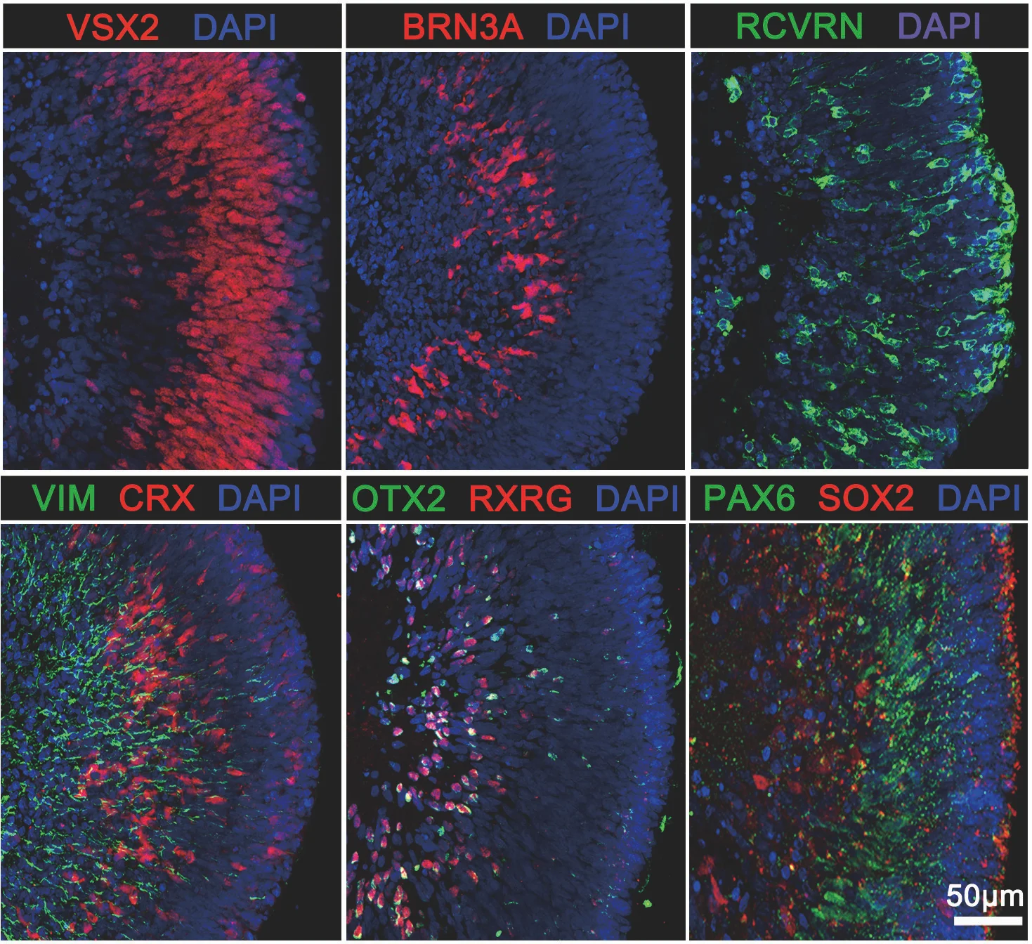 Discovery of Human Retinal Stem-Like Cells Brings Hope for Vision ...