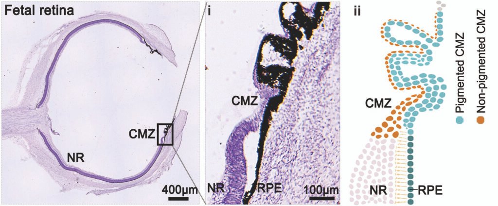 Discovery of Human Retinal Stem-Like Cells Brings Hope for Vision ...