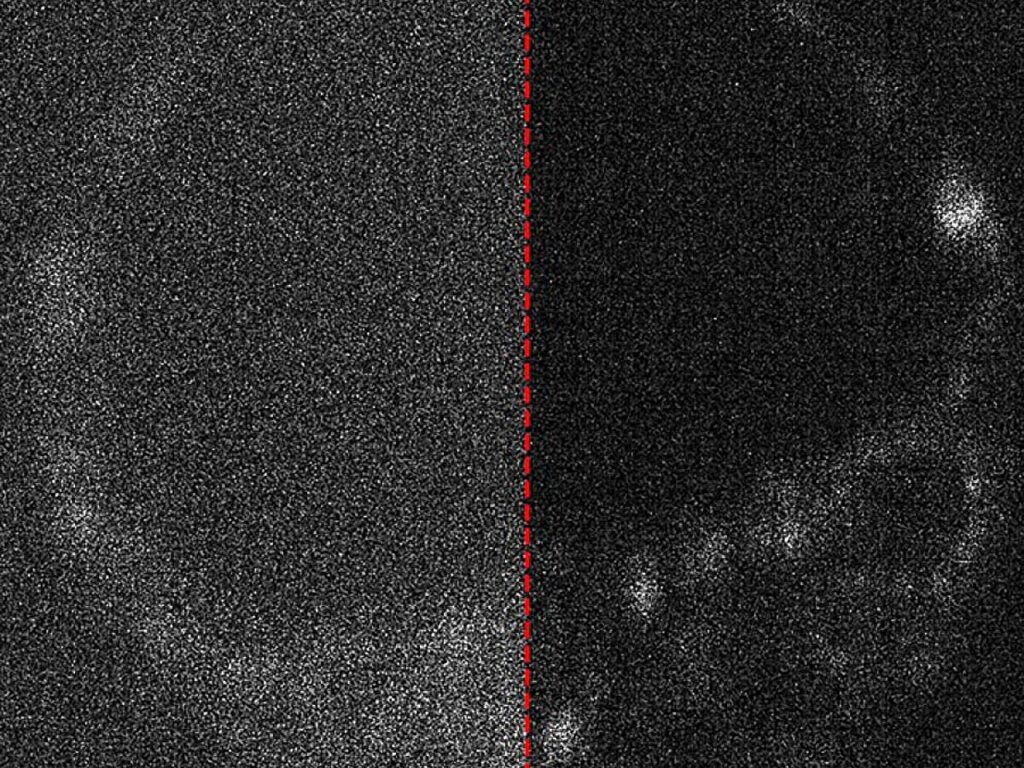Quantum Cameras Reveal Secrets of Embryo Development