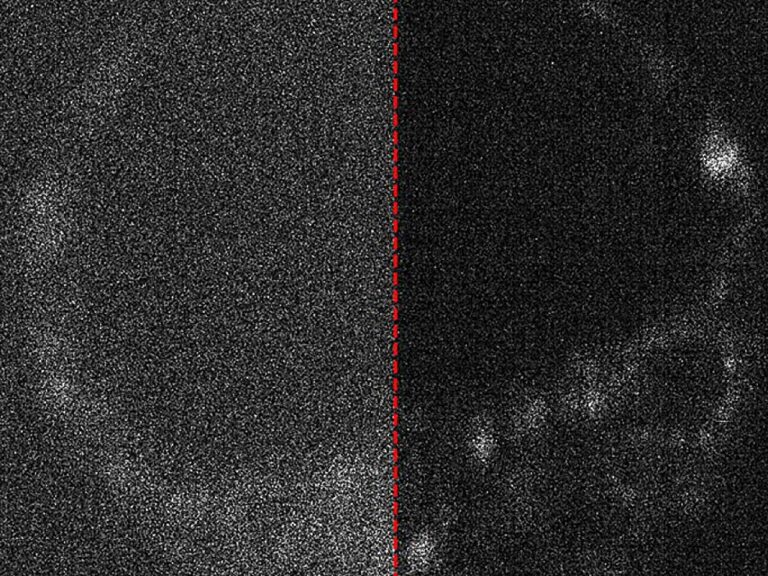 Quantum Cameras Reveal Secrets of Embryo Development