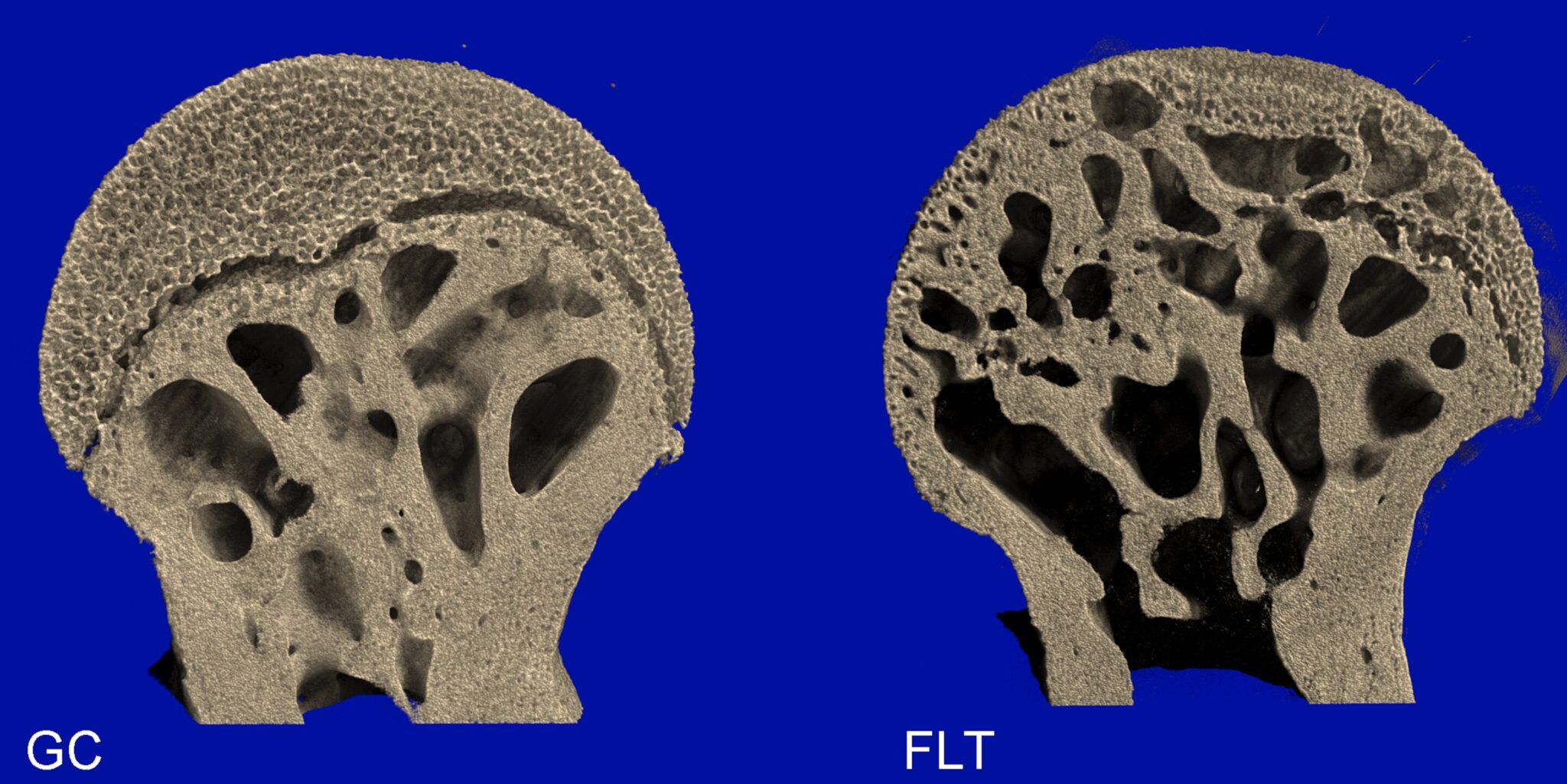 Study Reveals Femur Bone Loss in Mice Due to Space Microgravity