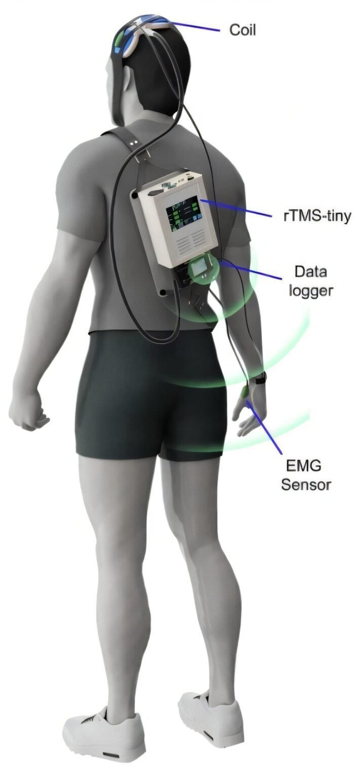 Battery-Powered Brain Stimulation Device Brings Treatment to Everyday Life