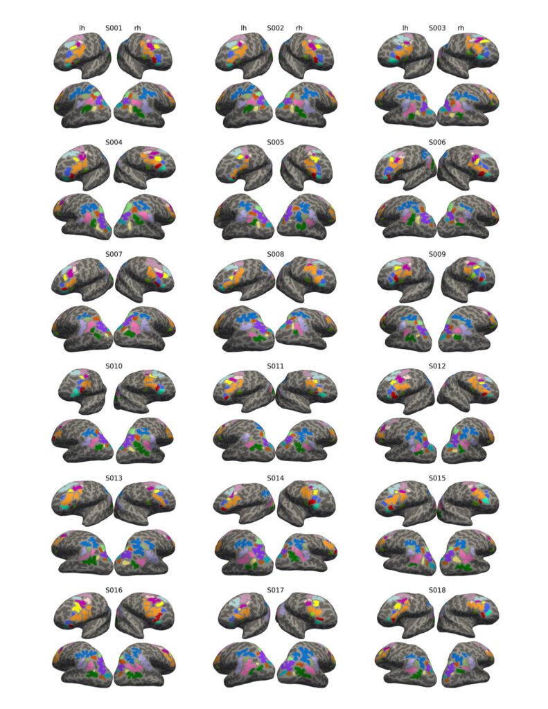 How Small Grooves in the Brain Shape Cognitive Power and Connectivity