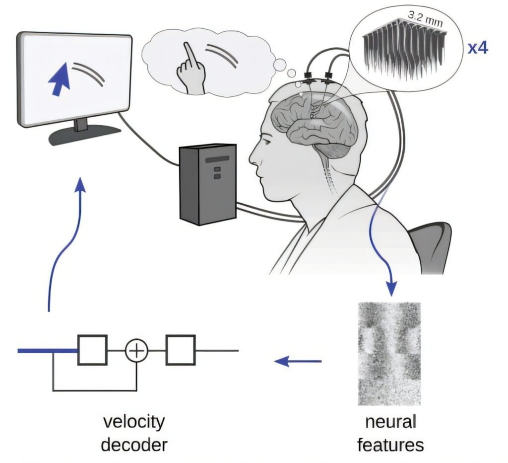 New Brain-Computer Interface Uses Speech Cortex to Control Computers