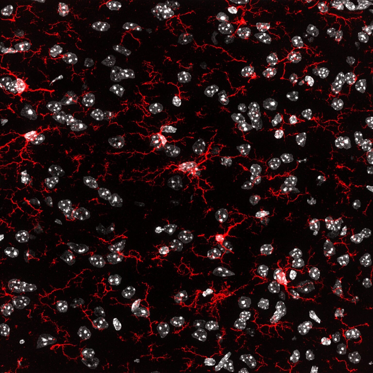 Scientists Reprogram Brain’s Immune Cells in Breakthrough Against ...