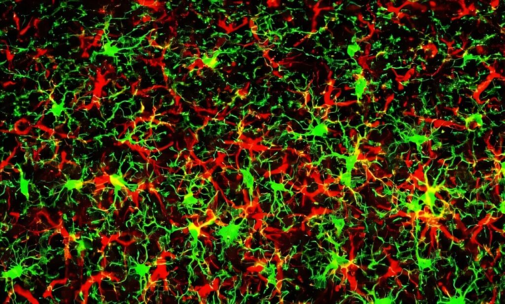 Scientists Discover the Switch That May Control Brain Decay