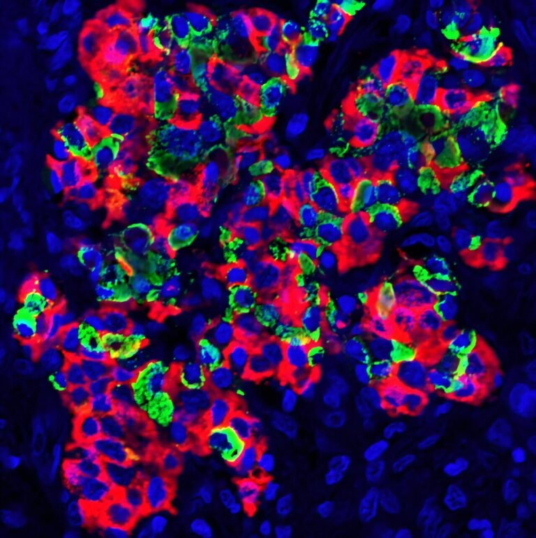 Scientists Transform the Spleen into a Diabetes-Fighting Powerhouse