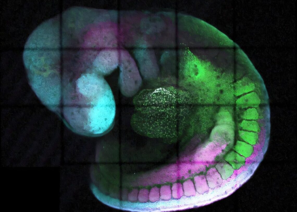 Why Some Animals Can Regrow Limbs