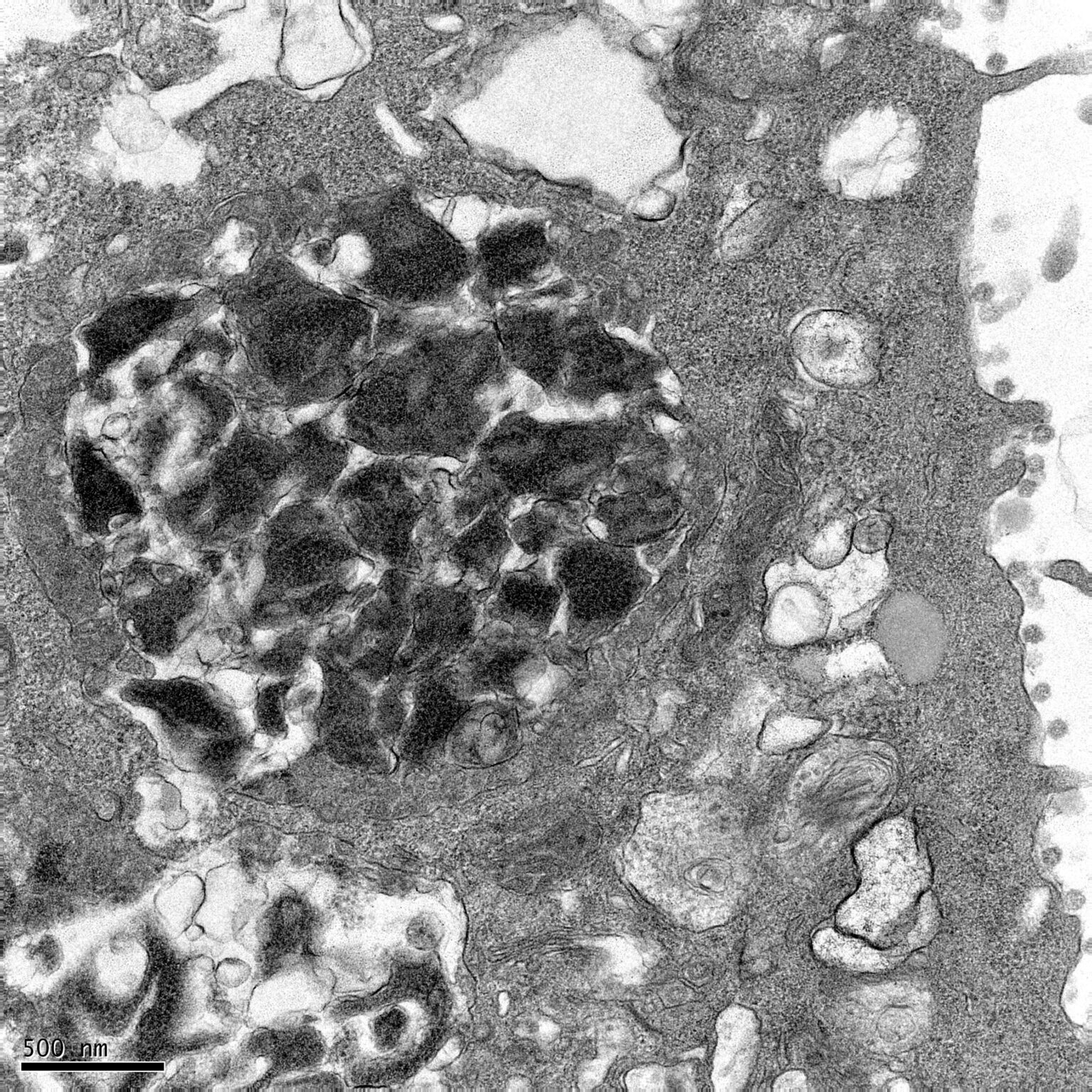 New Discovery Reveals How SARS-CoV-2 Shields Its Spike Protein for More ...