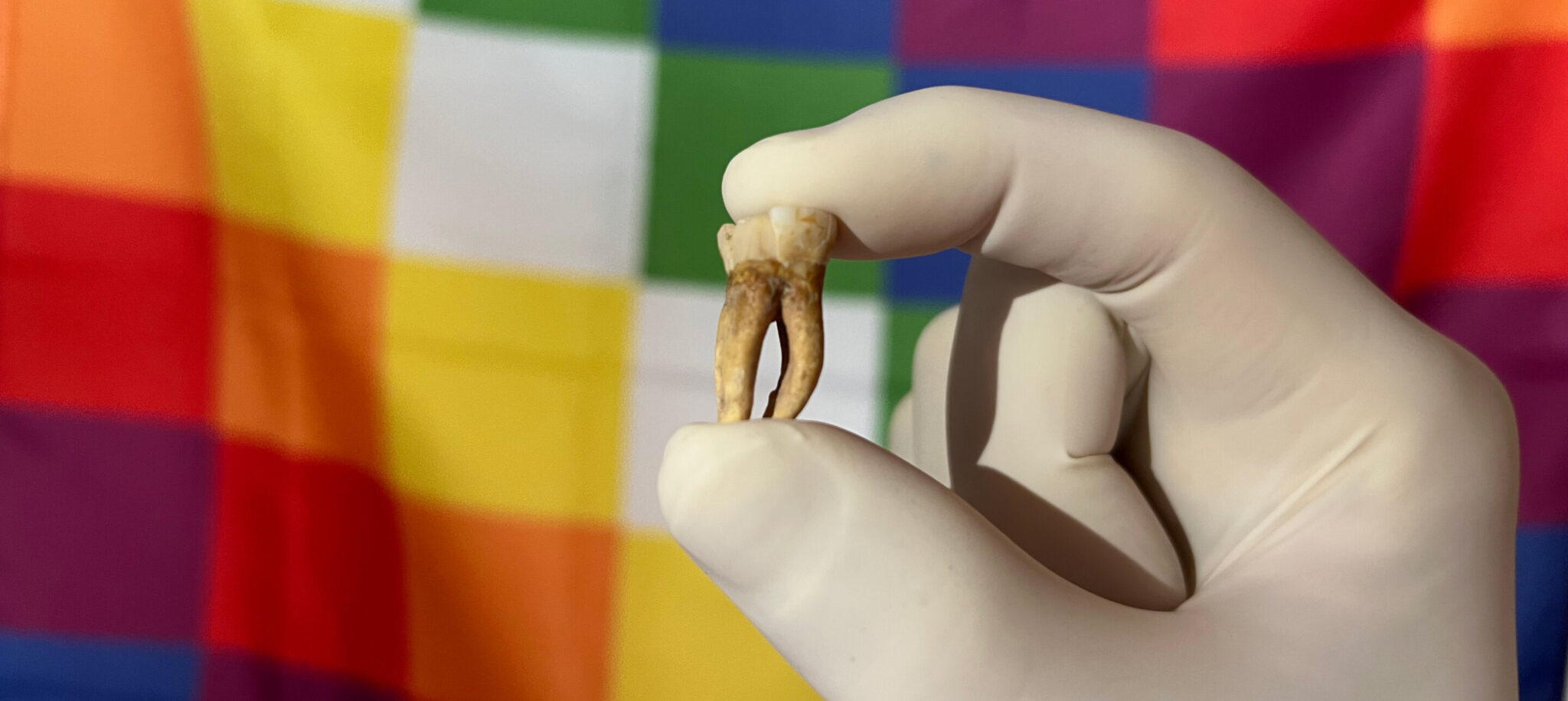 Leprosy Lived in the Americas Long Before Europeans Set Foot There