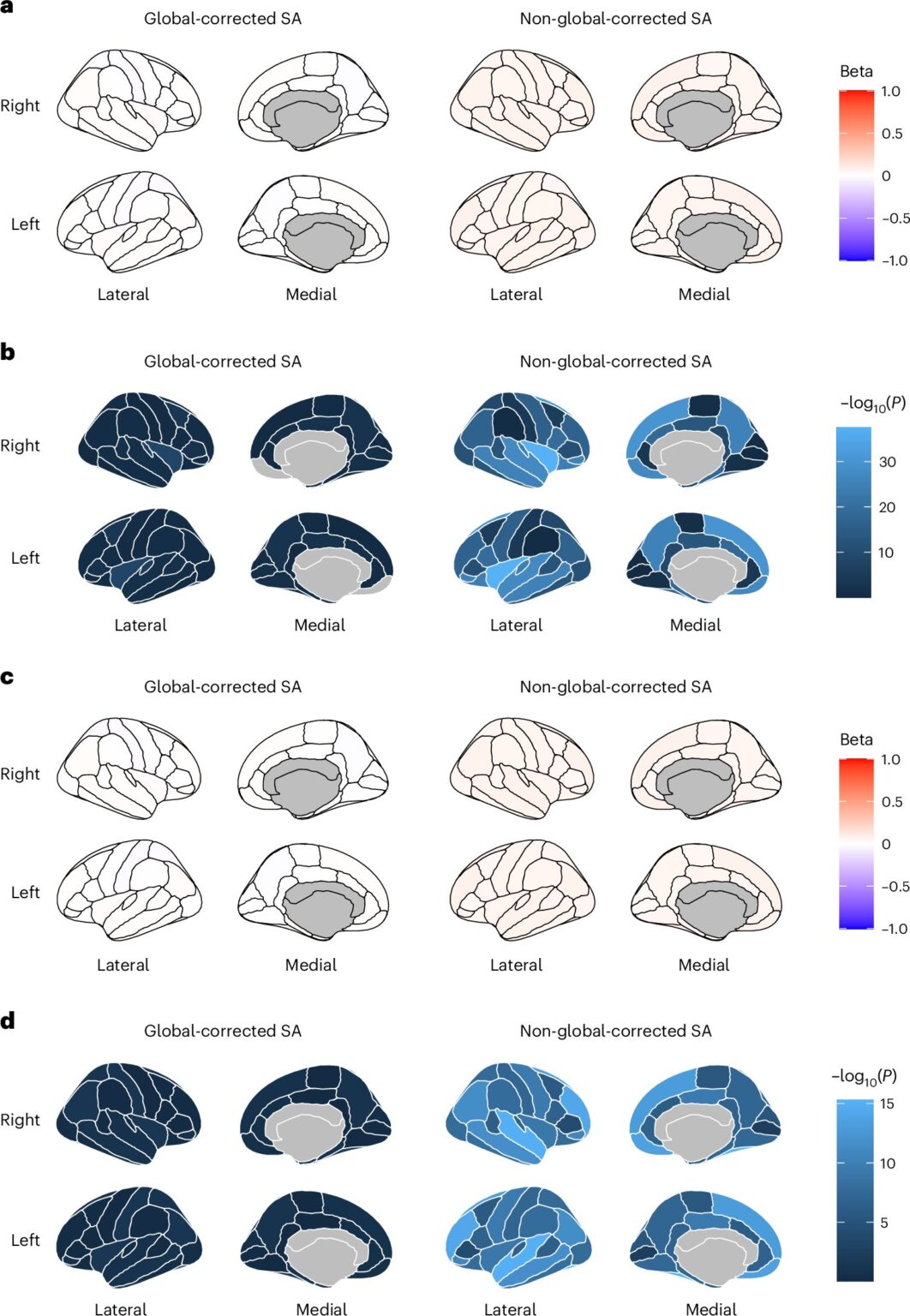 New Study Reveals Brain Structure Can Predict Risk for Schizophrenia ...