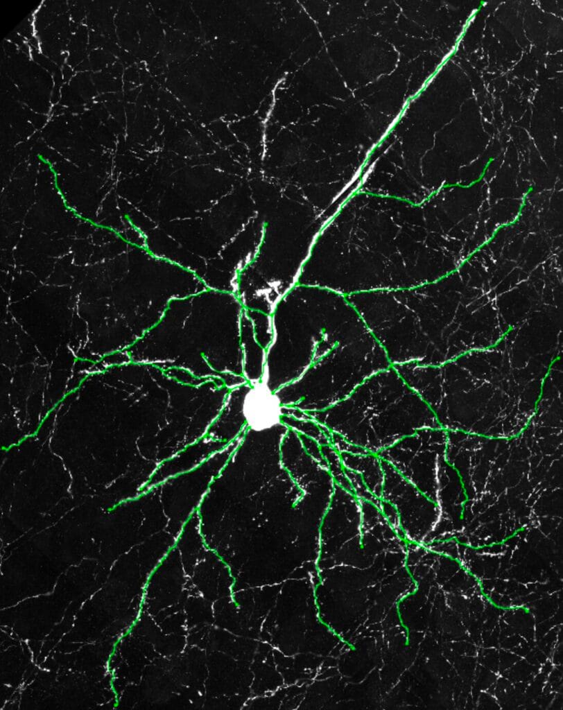The Sleep Gene That May Have Helped Build the Human Mind