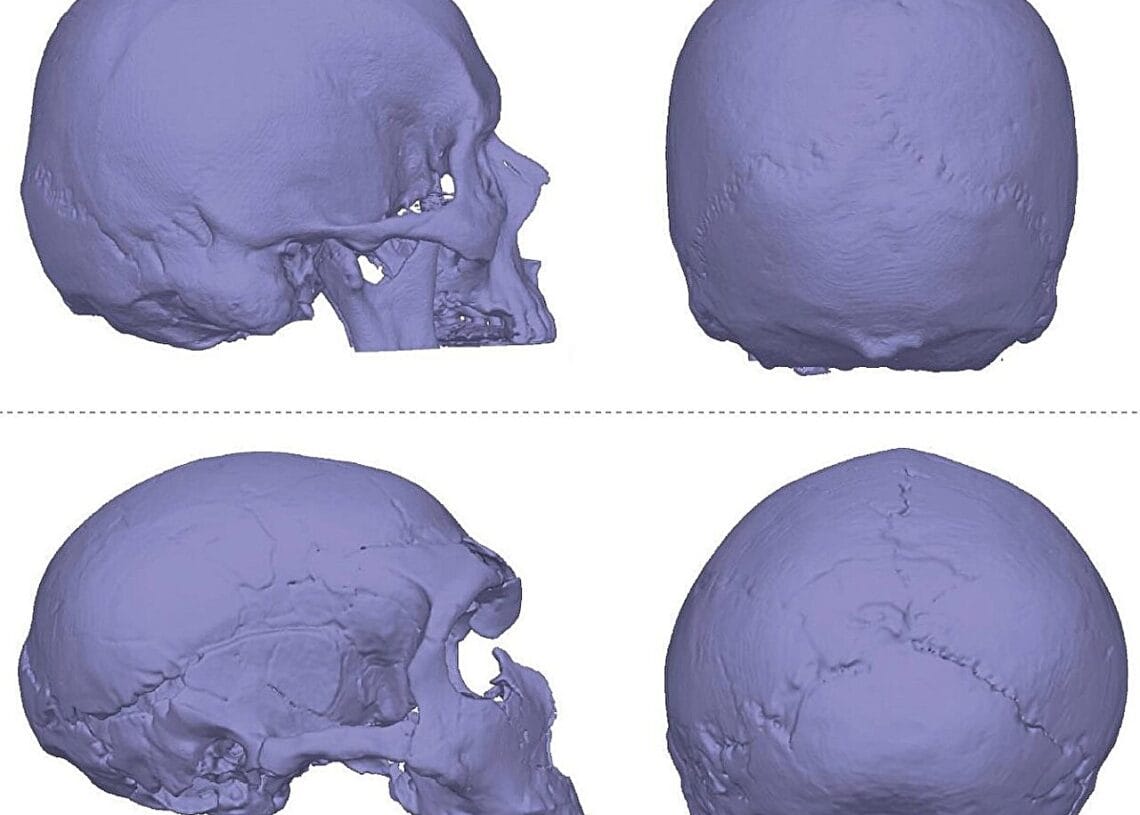 The Weirdest Mutations in Nature