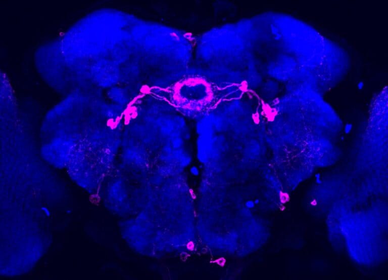 Flies Dream Too and Their Tiny Brains Hold the Secret of Sleep