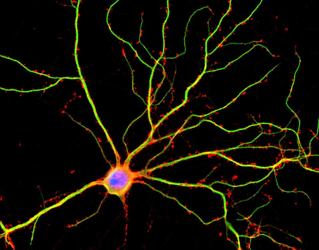 What is Neuroscience? The Science of the Human Brain and the Mystery of ...