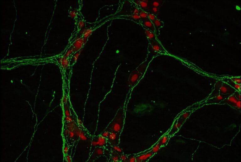 Scientists Discover Gut Neurons Hold the Key to Stopping Inflammation