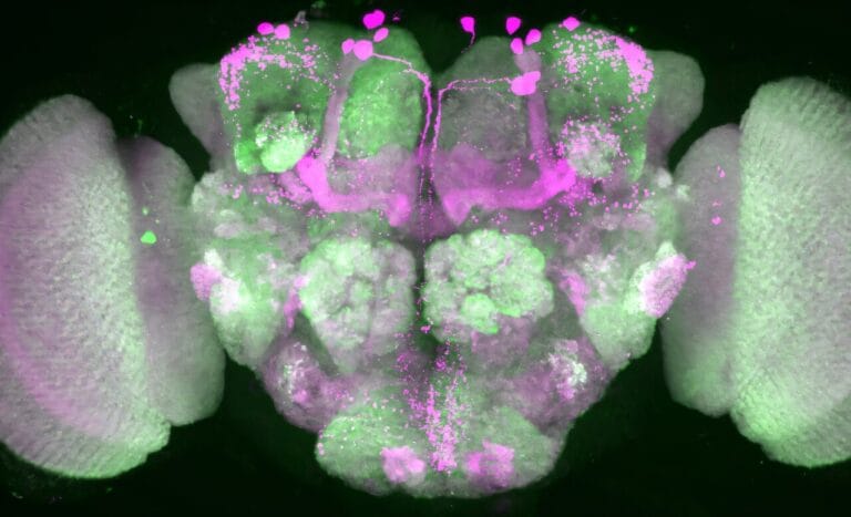 Flies Dream Too and Their Tiny Brains Hold the Secret of Sleep