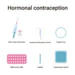 IUDs, Pills, and Patches: How Hormonal Contraception Actually Works