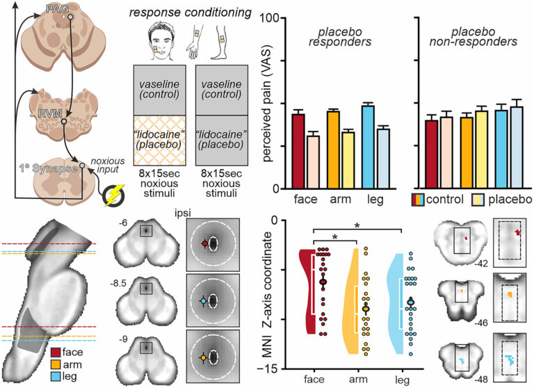 Scientists Uncover Hidden Map in the Brain That Shows Where Pain Lives ...