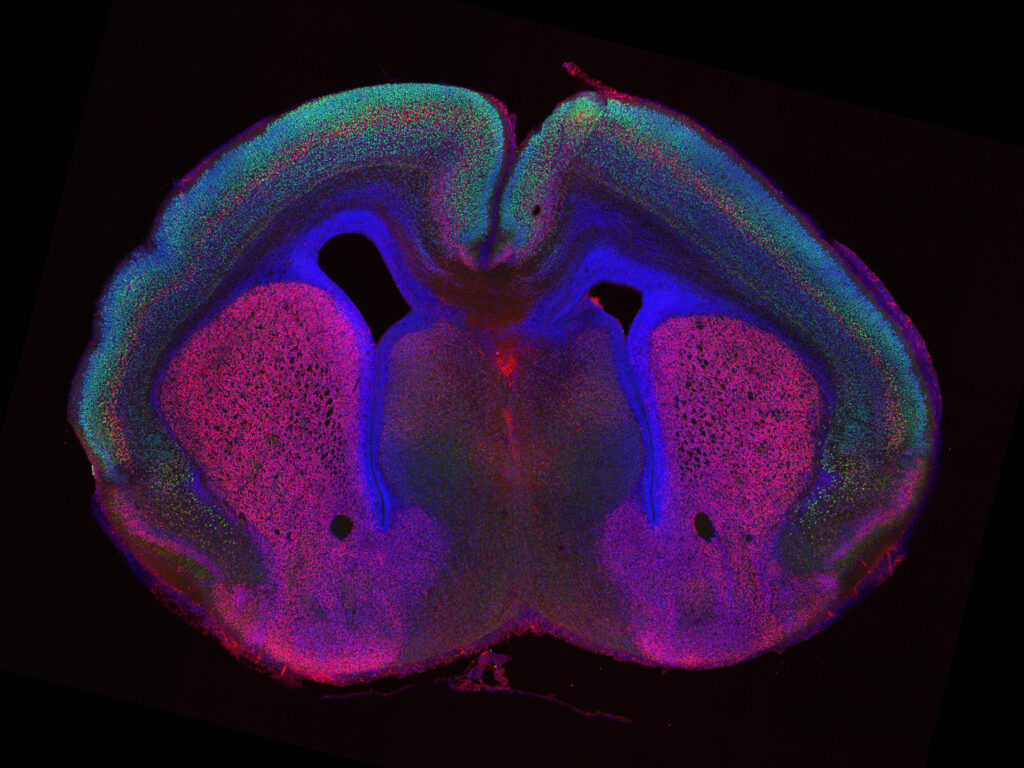 Human Brain Wrinkles May Hold the Secret to Our Intelligence
