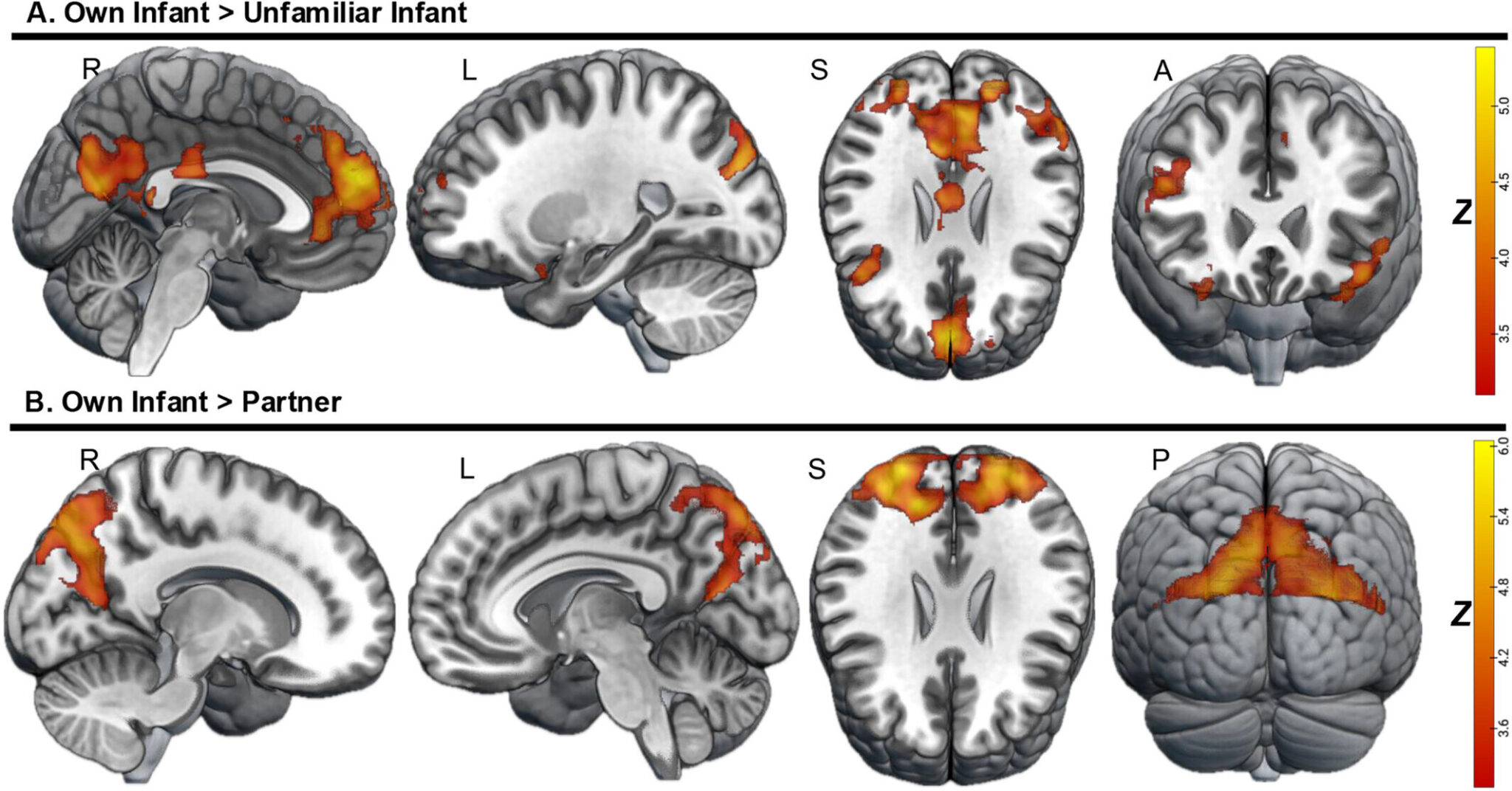 Scientists Discover What Really Happens in a New Dad’s Brain When He ...