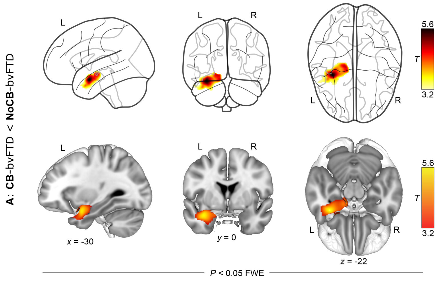 Can You Blame the Brain? The Shocking Link Between Dementia and ...