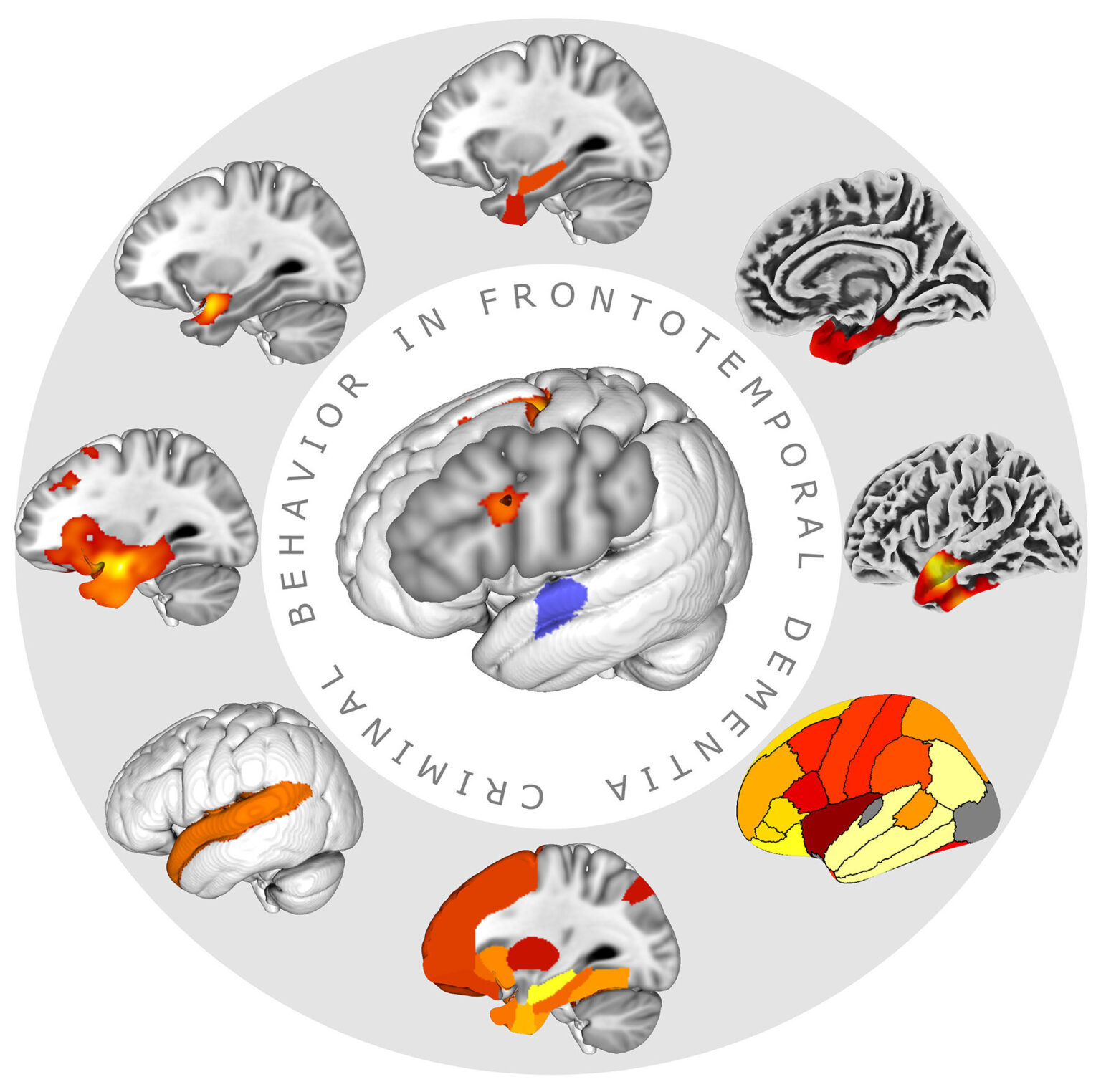 Can You Blame the Brain? The Shocking Link Between Dementia and ...