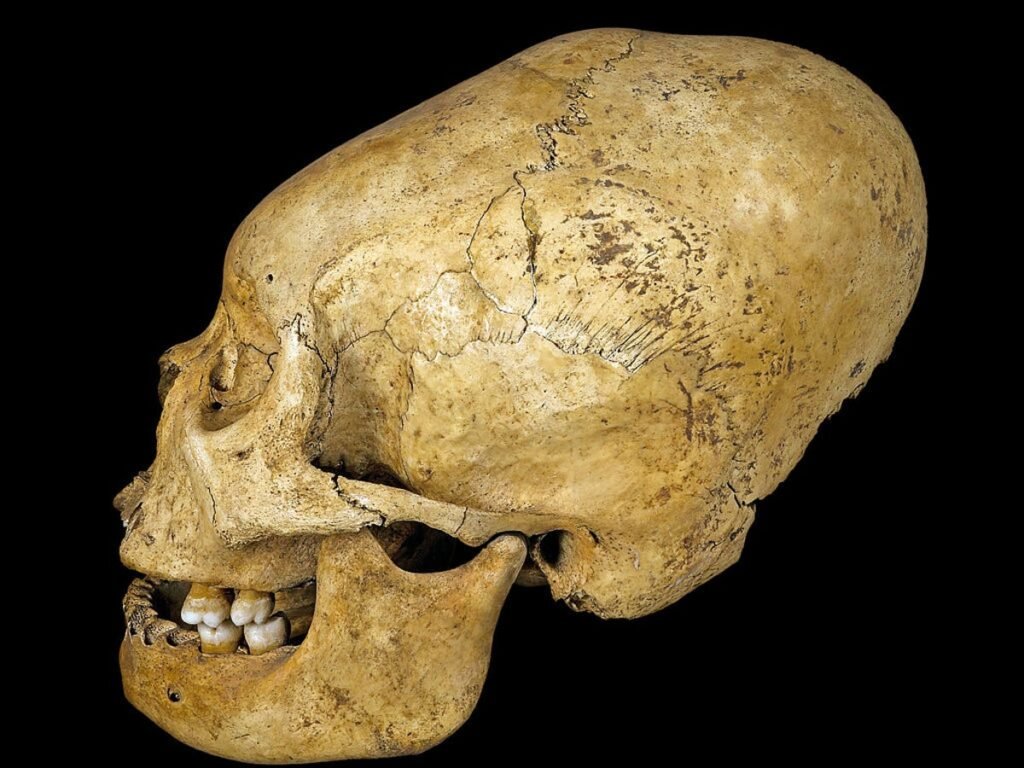 The Unusual Cranial Elongation Practices in Ancient Peru