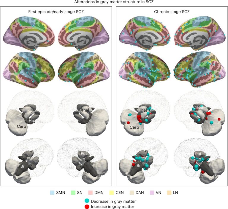 Scientists Map the Hidden Brain Changes Behind Schizophrenia—And It ...
