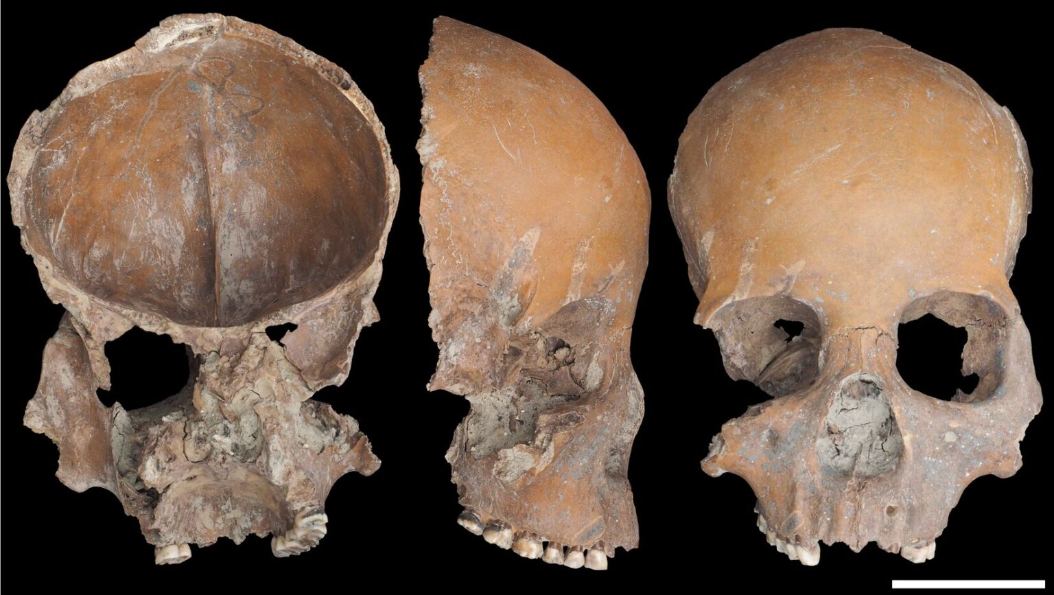5,000-Year-Old Bones Found in Canals Reveal a Dark and Strange Ritual ...