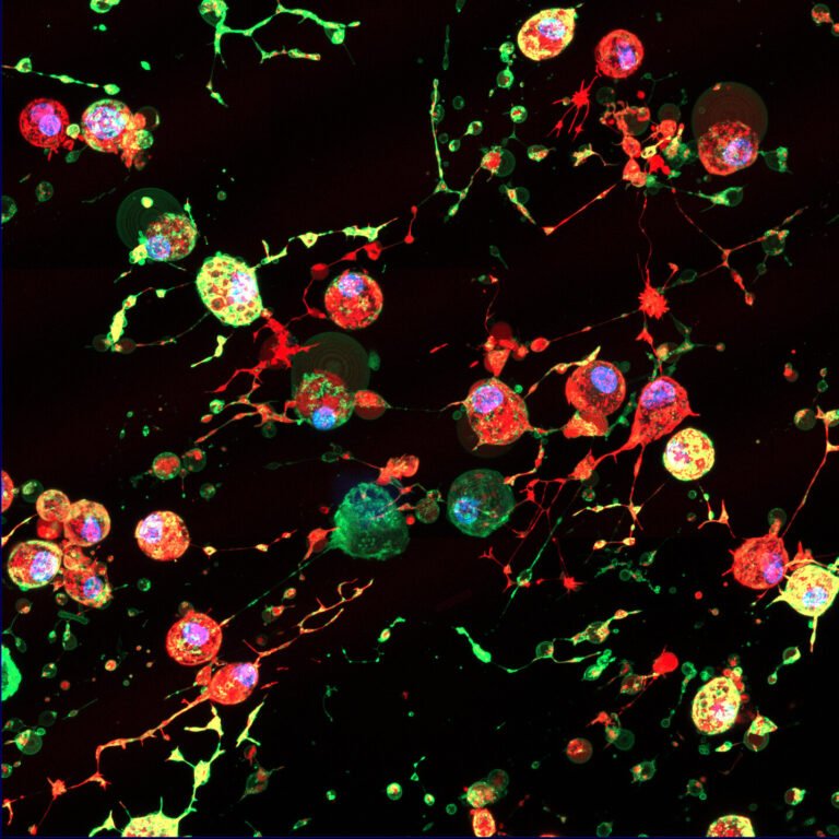 Scientists Uncover “Footprint of Death” — and How Viruses Use It to ...