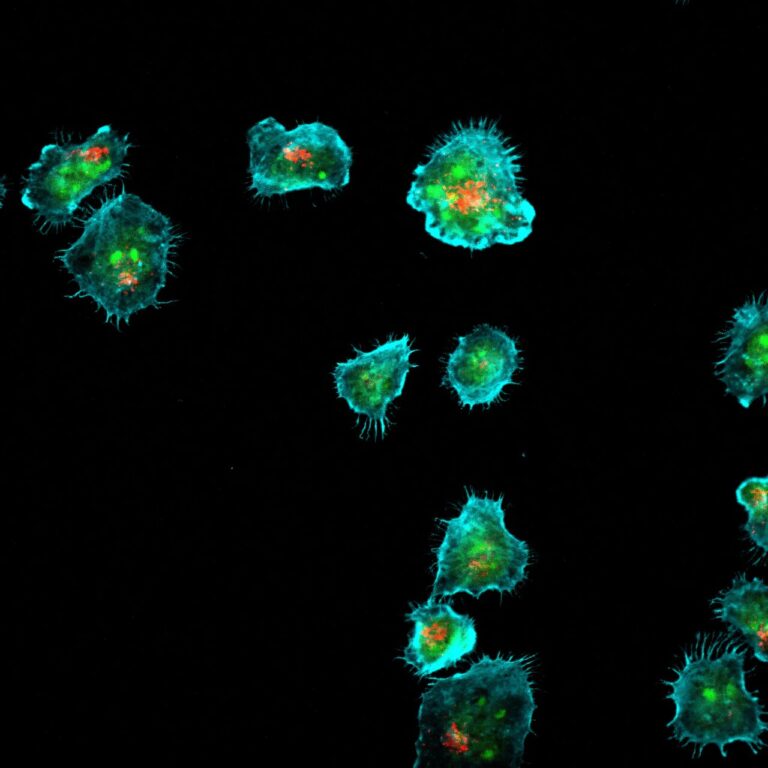 Scientists Discover Fat Molecules Secretly Guide the Body’s Killer ...