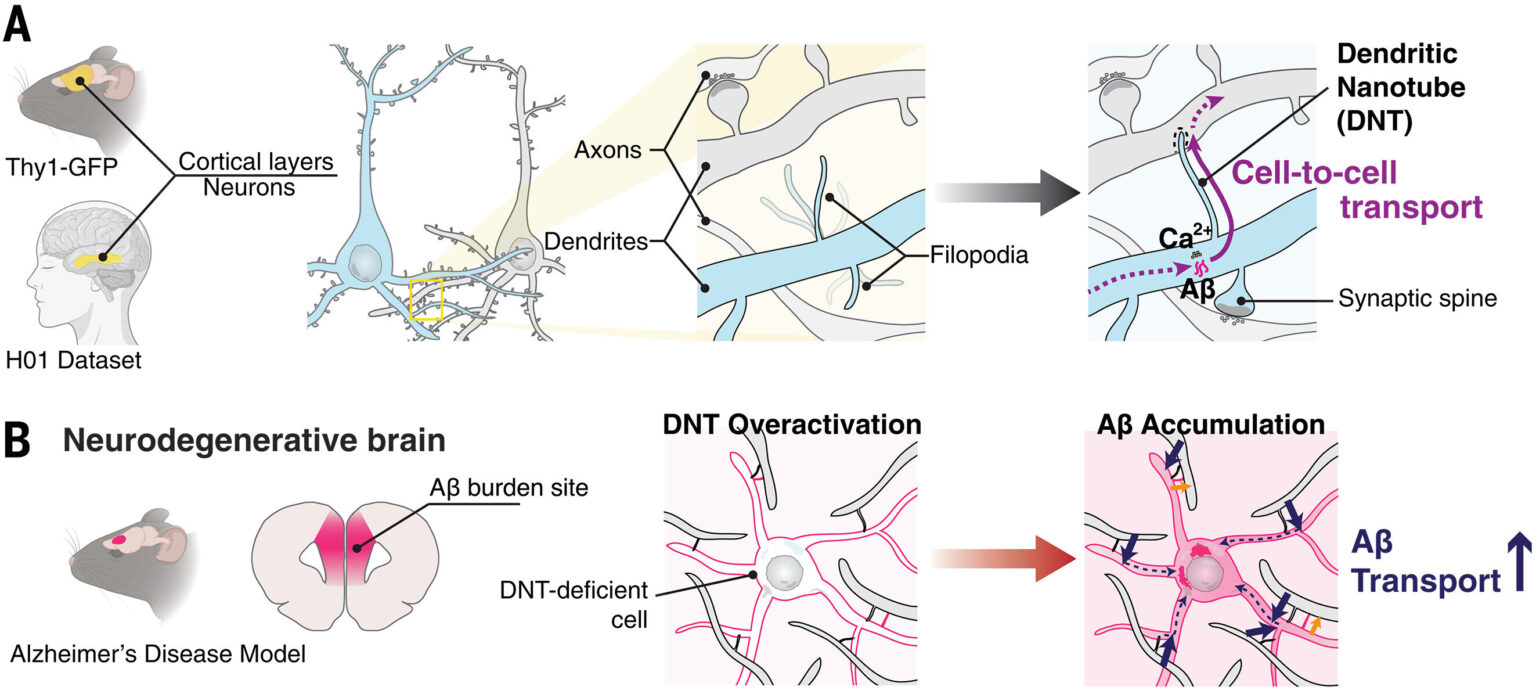 Scientists Discover Hidden Brain Bridges That Could Explain How ...