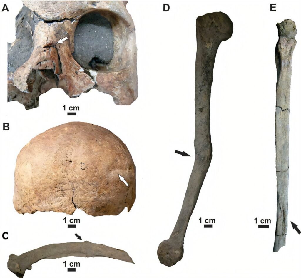 These 4,000-Year-Old Bones Reveal a Shocking Secret About Humanity’s ...