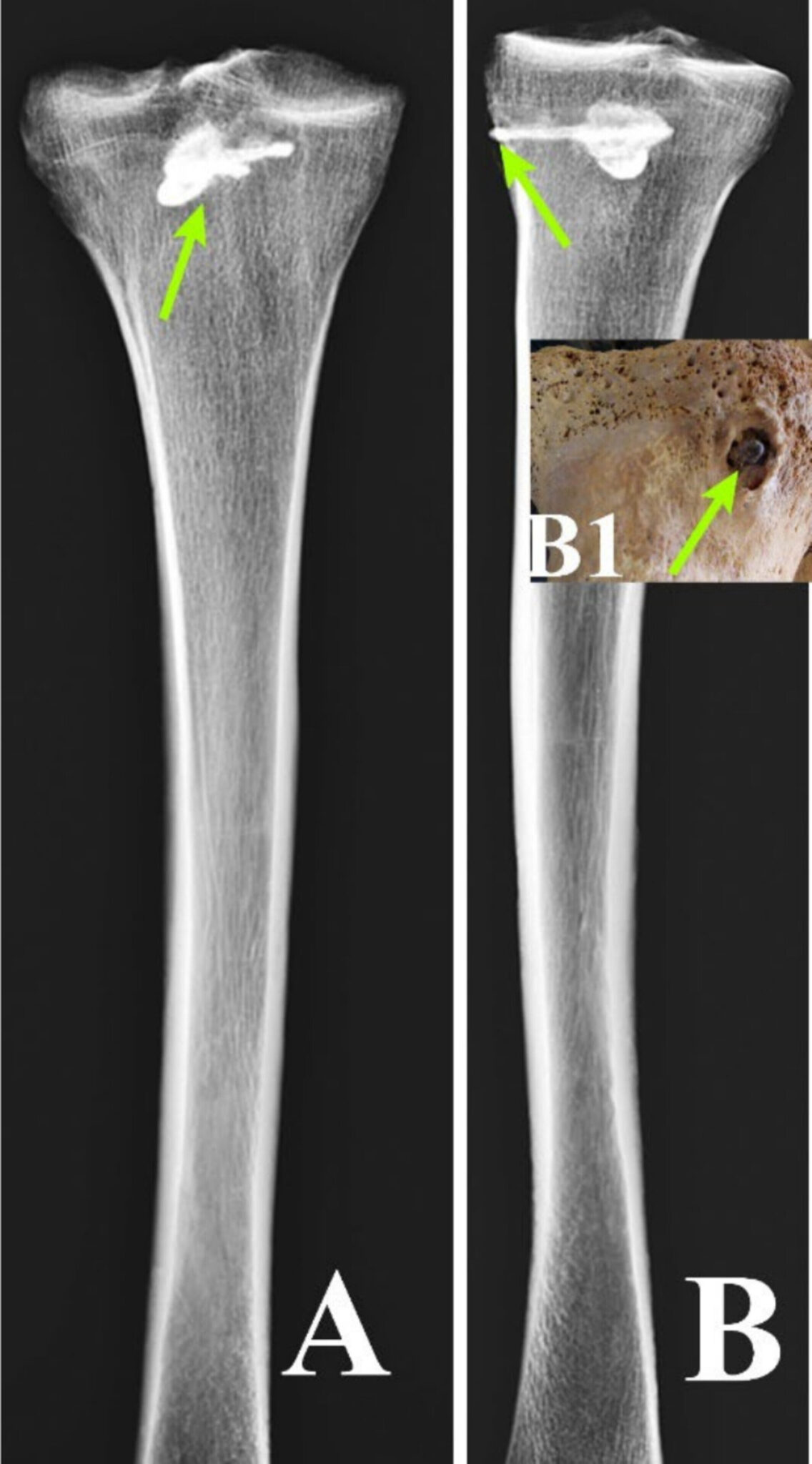 Archaeologists Uncover Ancient Skeleton with Arrow Still Lodged in the ...