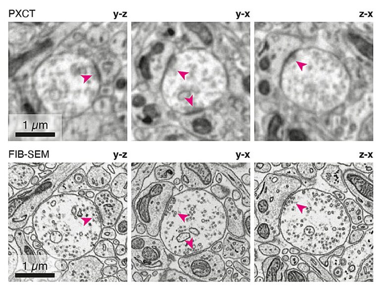 Scientists Capture 3D Brain Circuitry in Mice Using X-Rays—No More ...
