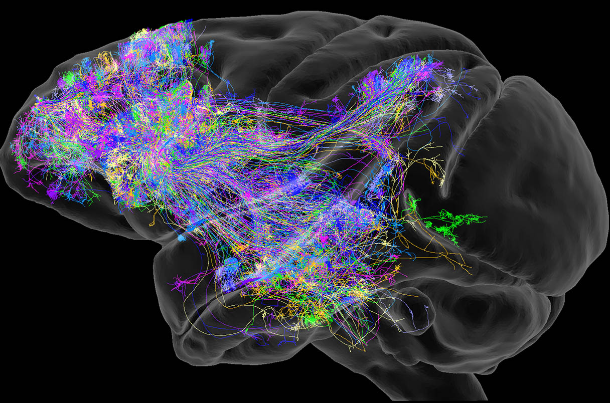 How AI Is Mapping the Human Brain Better Than We Can