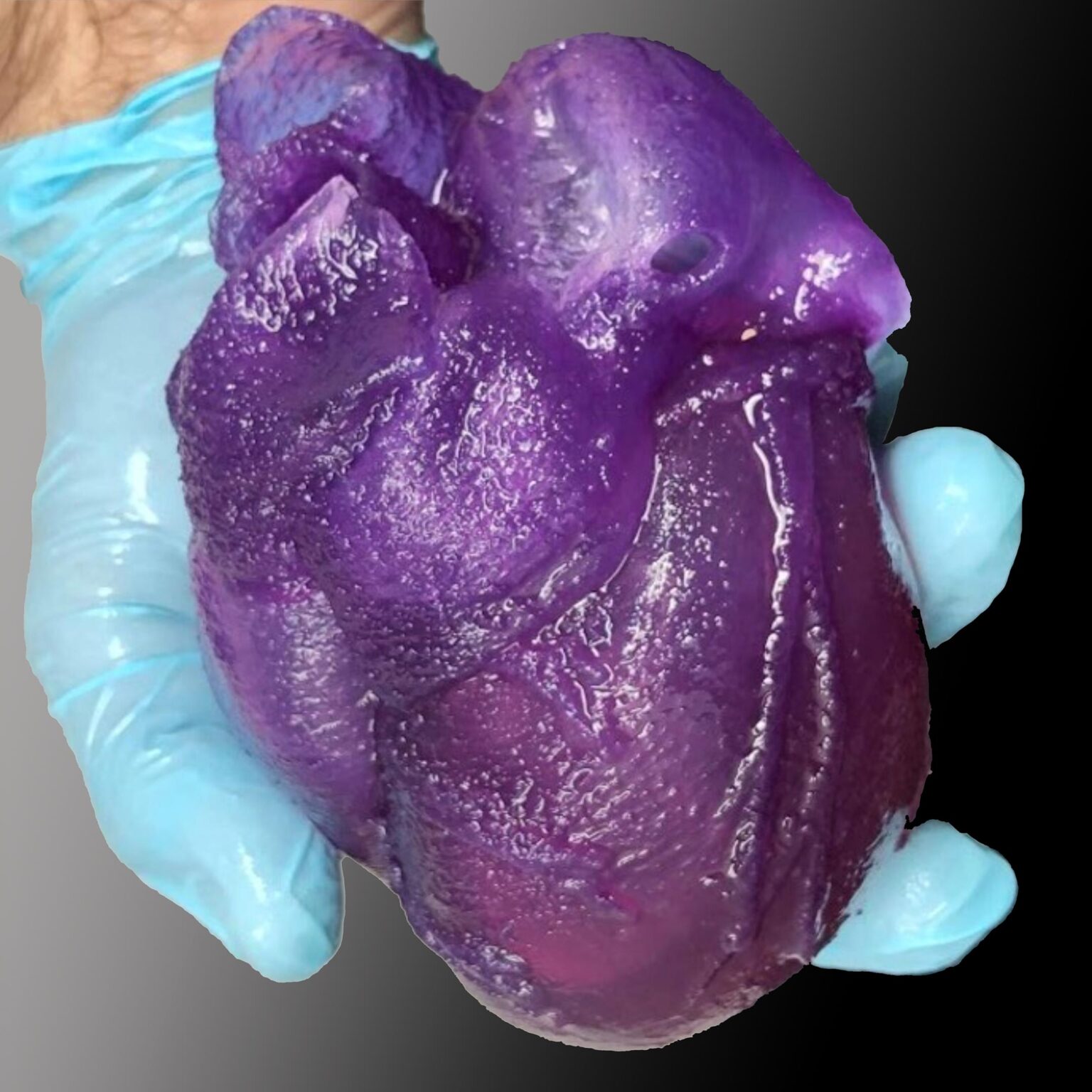3D Bioprinting: Can We Print a Functioning Human Heart?