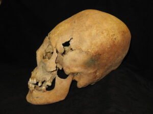 5 Ancient Civilizations That Practiced Cranial Deformation