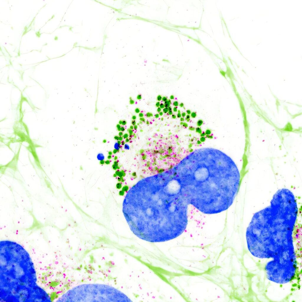 Scientists Solved a 60-Year Collagen Mystery—and It Could Change How We ...